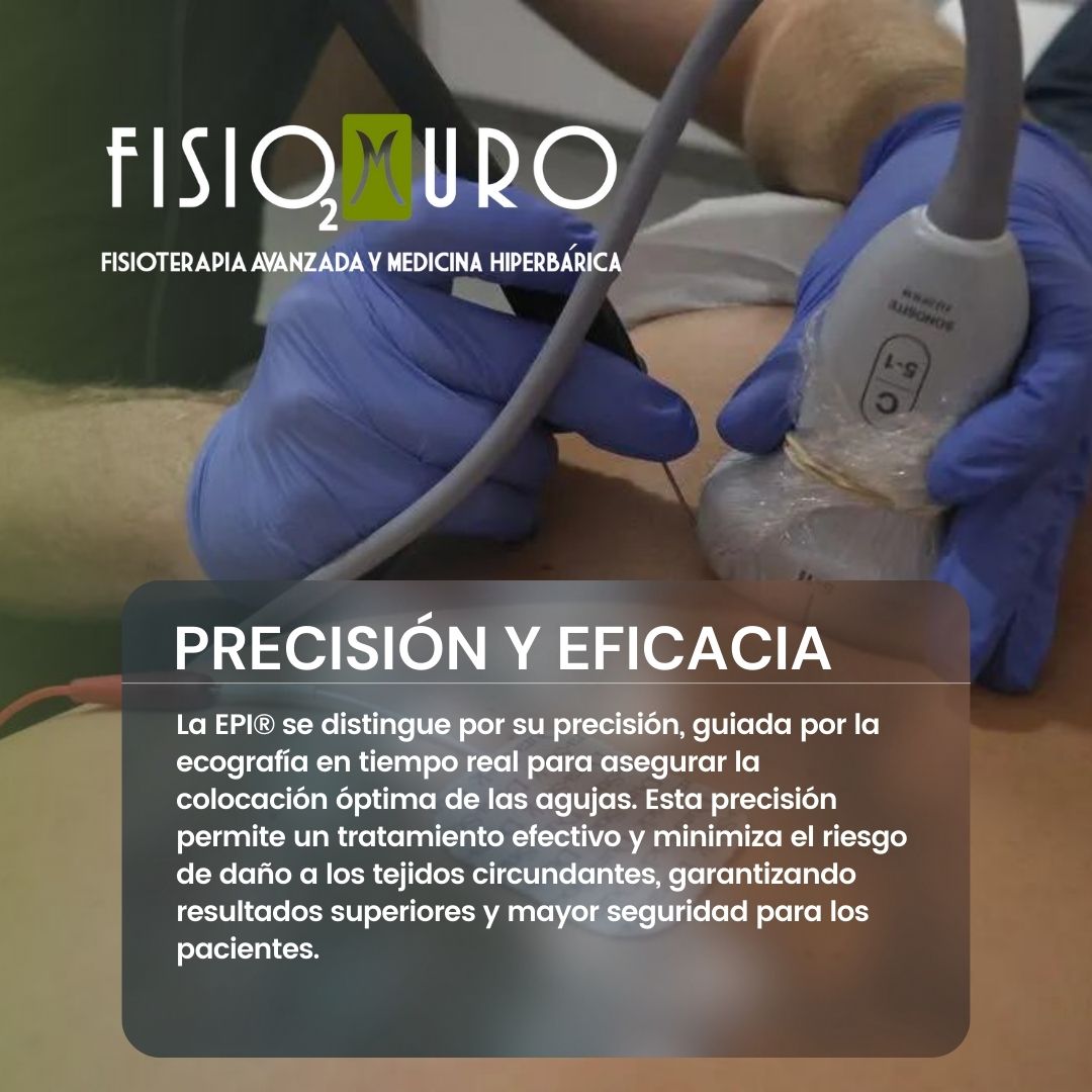 ELECTROLISIS PERCUTÁNEA INTRATISULAR (EPI®): TRATAMIENTO REVOLUCIONARIO ...