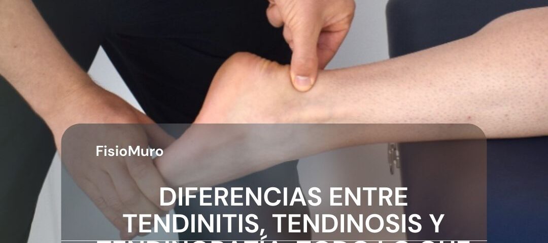 DIFERENCIAS ENTRE TENDINITIS, TENDINOSIS Y TENDINOPATÍA: TODO LO QUE ...